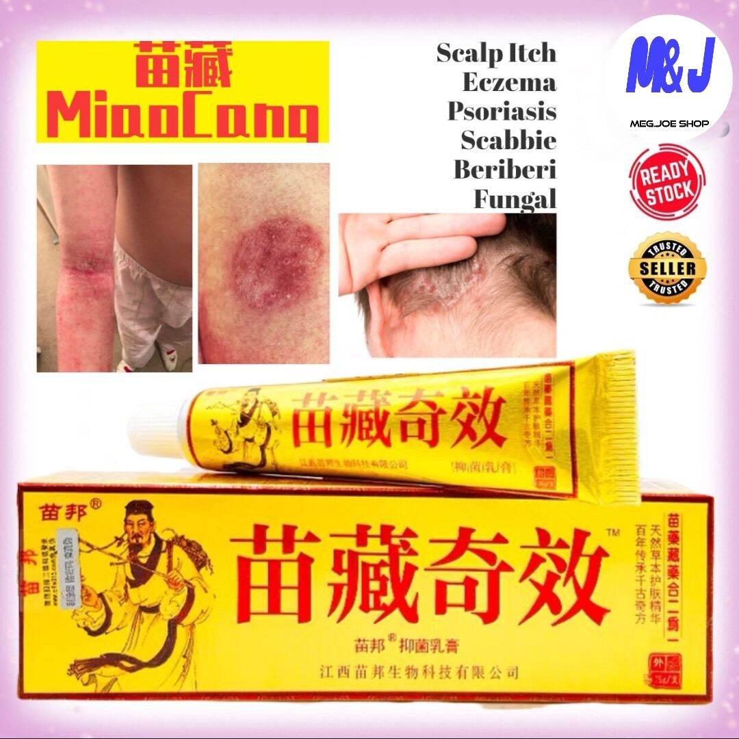 苗邦苗藏奇效抑菌草本乳膏湿疹牛皮癣顽固癬蚤痒 Eczema Psoriasis Scalp Dermatitis Antifungal ...