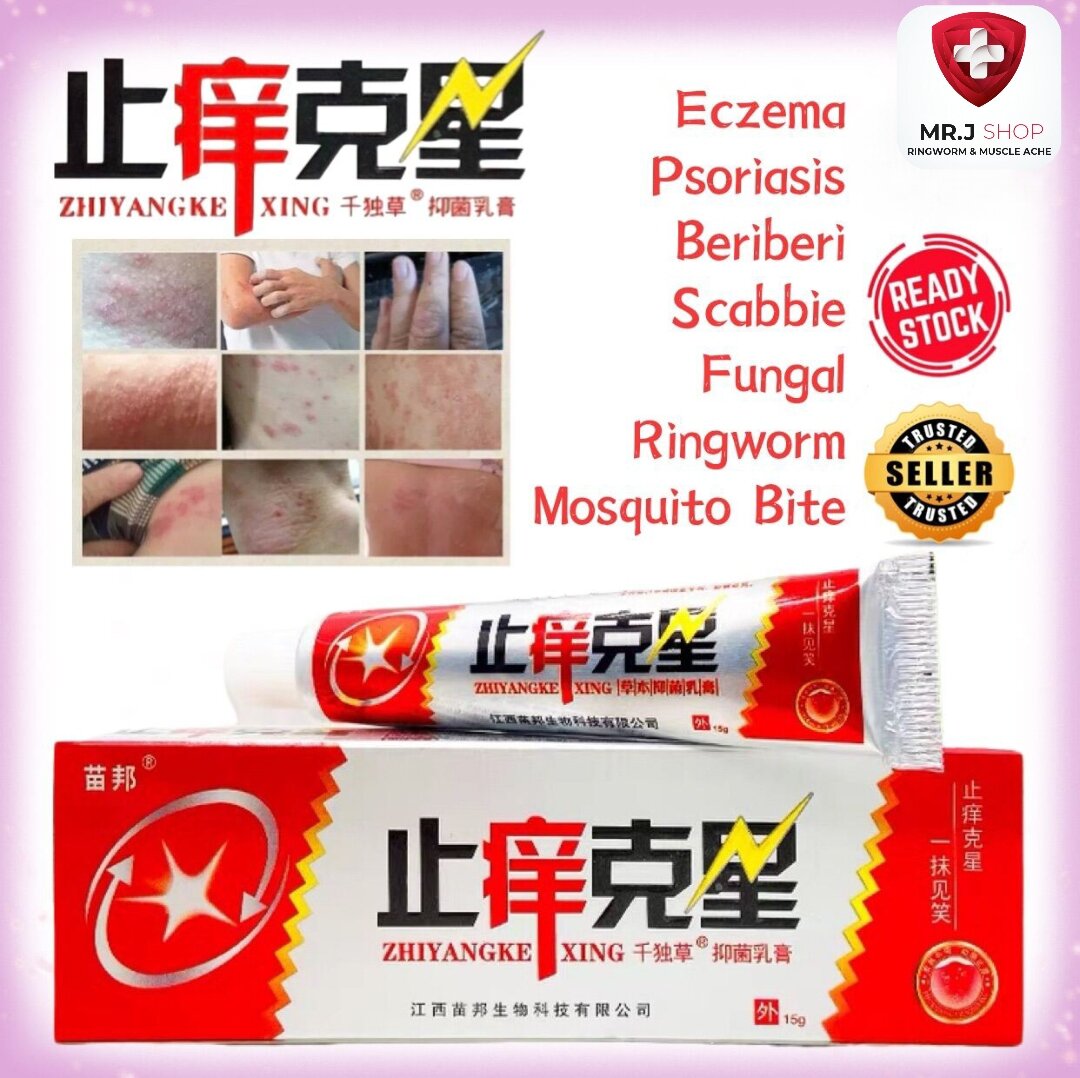 止痒克星 Eczema Psoriasis Scalp Dermatitis Antifungal Itching Skin Cream ...