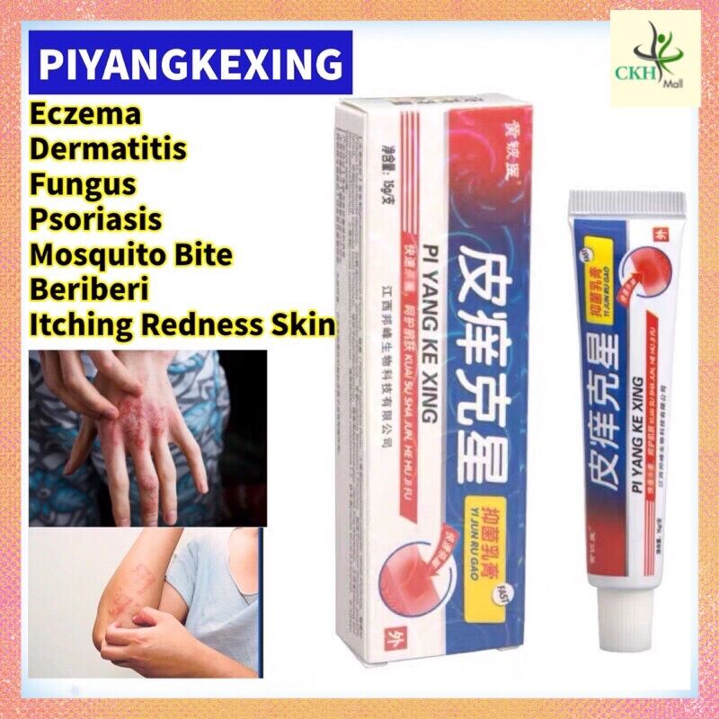 Krim Skin Itchy Treatment Antifungal Antiseptic Cream 15g 皮痒克星 抑菌乳膏 ...