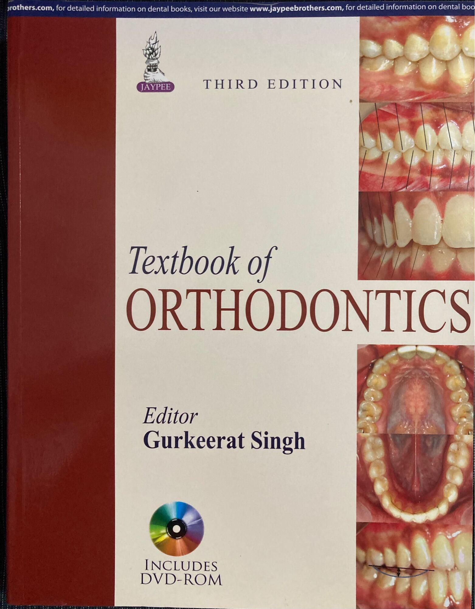 Textbook of Orthodontics/ Gurkeerat Singh 3rd Edition | Lazada