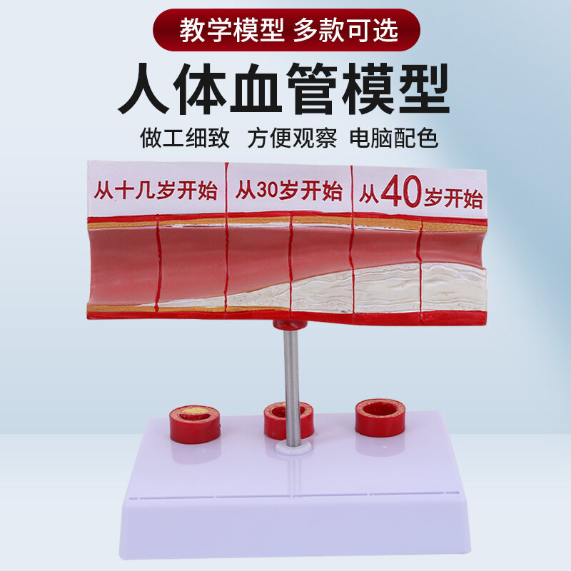 Simulation of Vascular Obstruction Degree Model of Ordinary People at ...