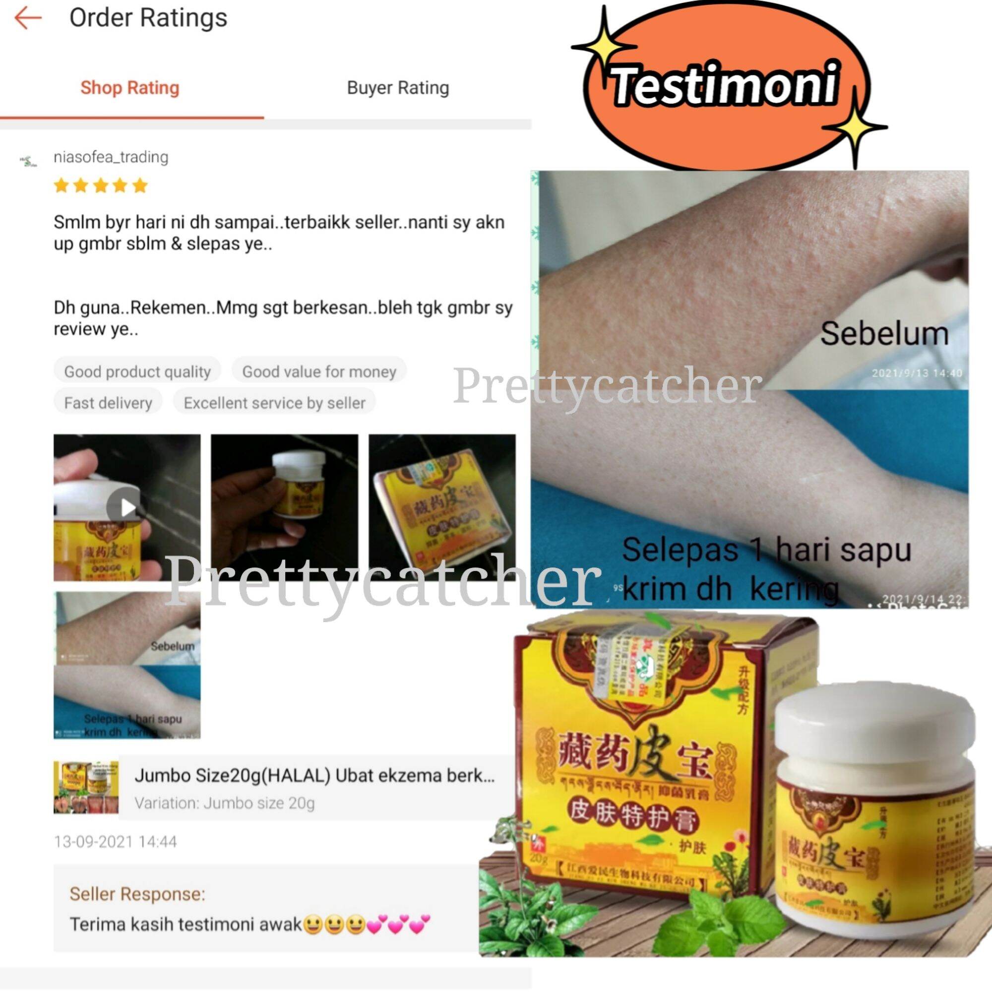 【Jumbo size 20g x 2】ORIGINAL Ubat hapus ekzema, psoriasis, gatal, kurap ...