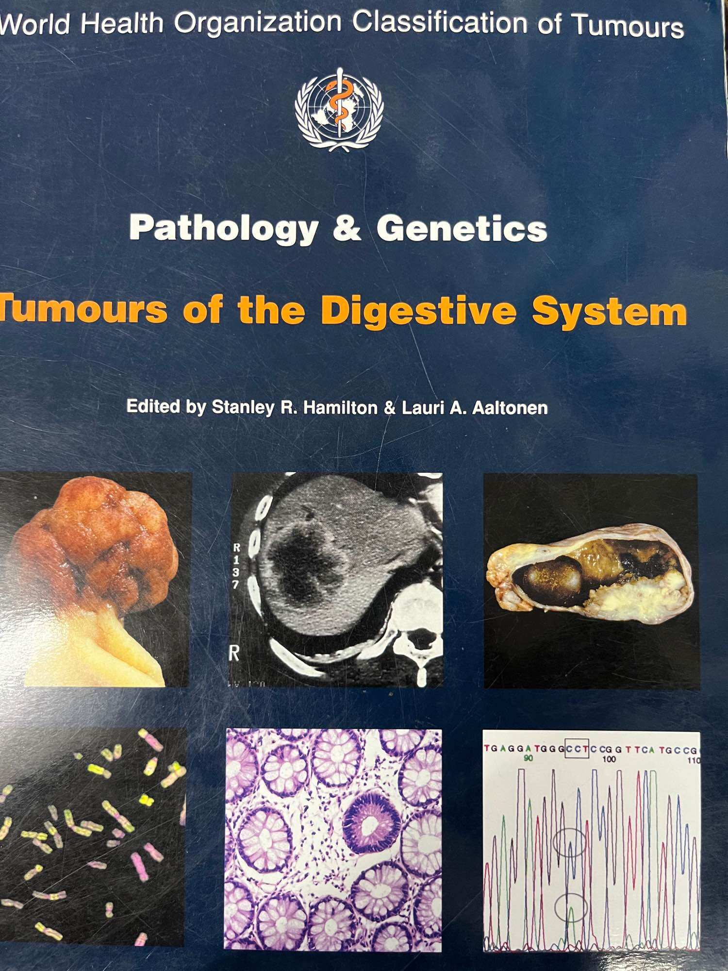 Pathology & Genetics Tumours of the Digestive System | Lazada