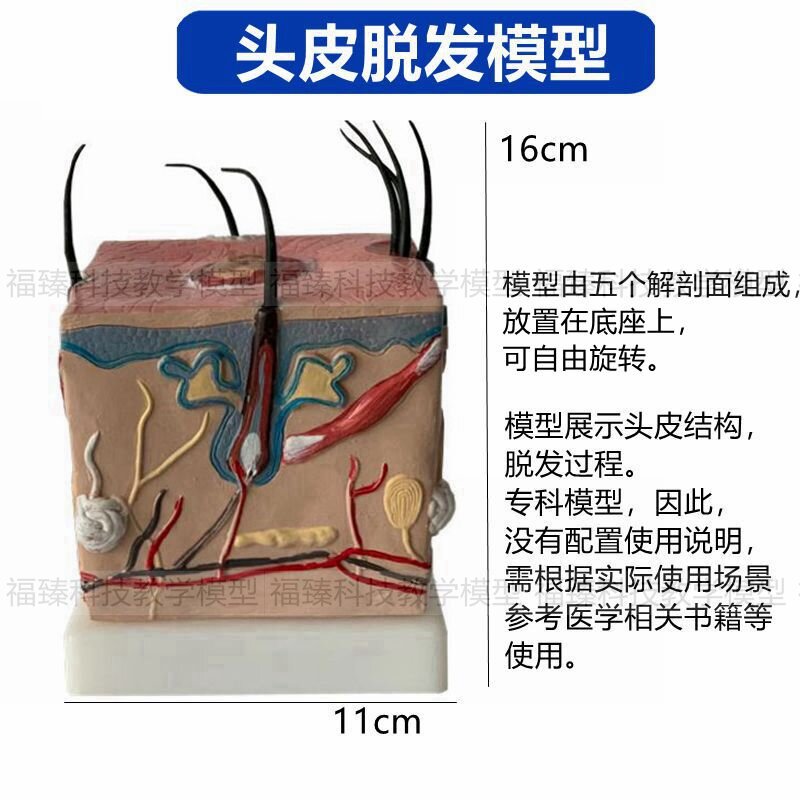 Hair Growth Cycle Model Scalp Structure Subcutaneous Tissue Hair Loss ...