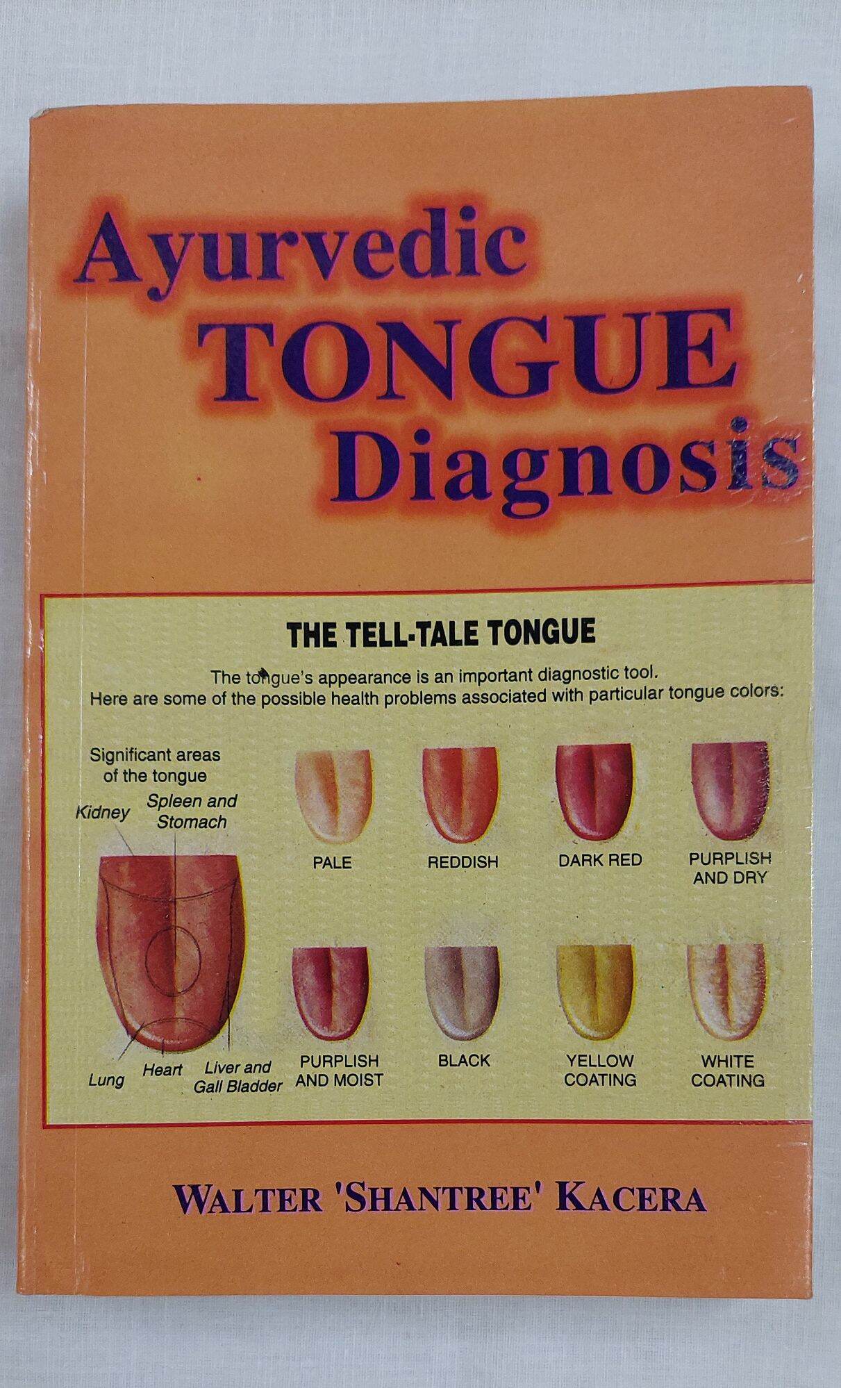 Ayurvedic Tongue Diagnosis English Book | Lazada
