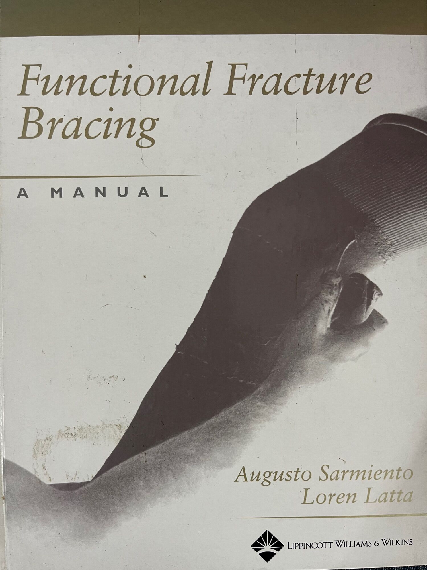 Functional Fracture Bracing | Lazada